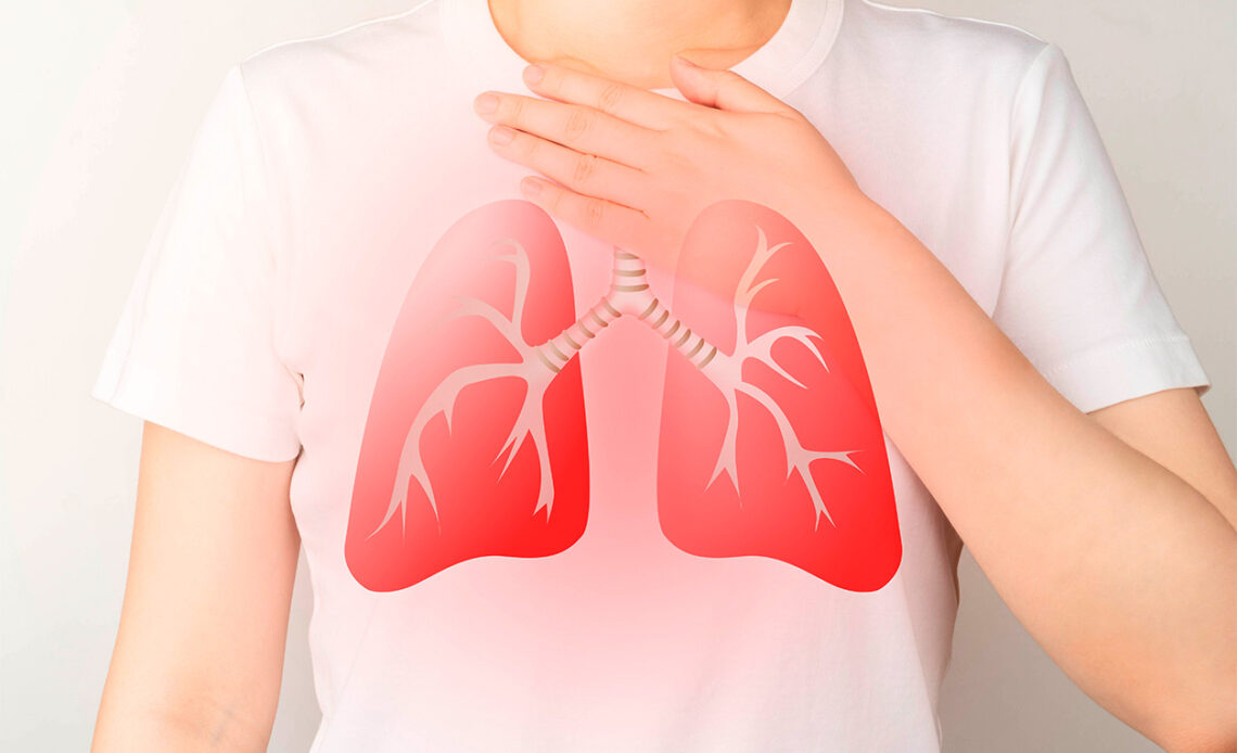 Tuberculosis pulmonar: Una enfermedad que exige atención y tratamiento ...