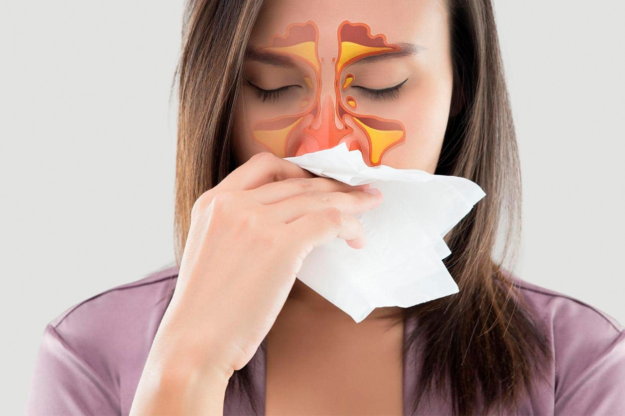 Hipertrofia de Cornetes: El desafío de respirar bien - Bago